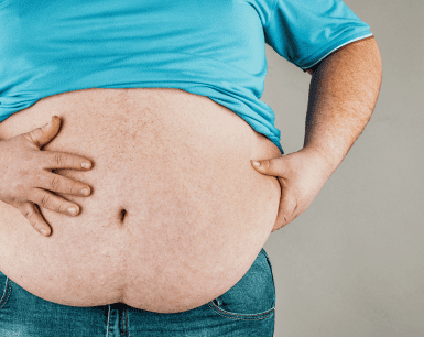 What is Morbid Obesity? Understanding the Condition and Exploring ...